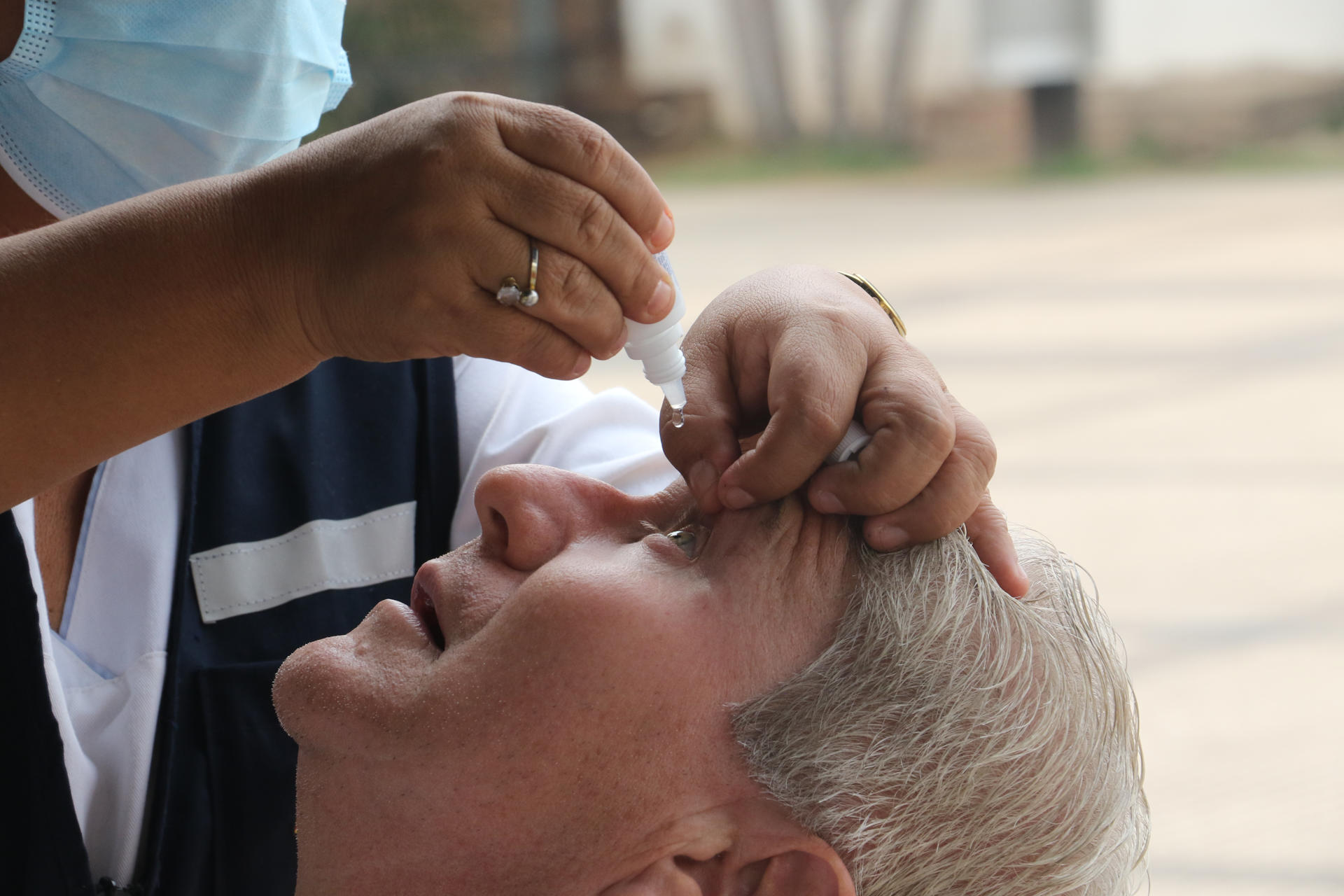 Chalazión en el ojo: causas y tratamientos - Noticias de Argentina y el ...