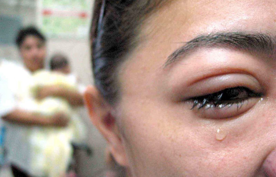 Conjuntivitis: síntomas y tratamiento eficaz