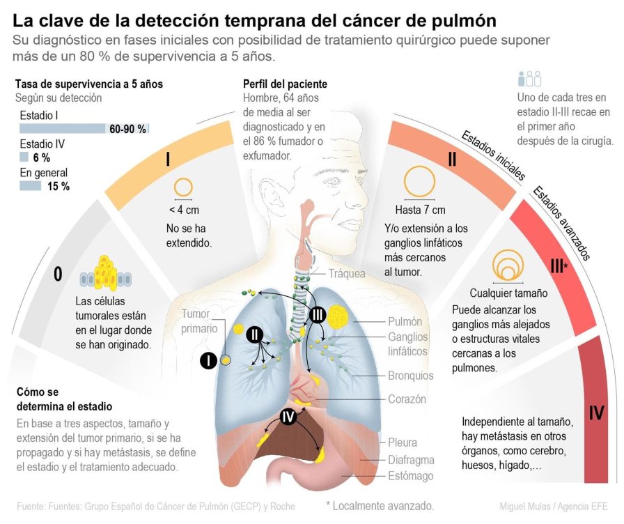 Oncólogos abordan avances en cáncer de pulmón en estadios tempranos