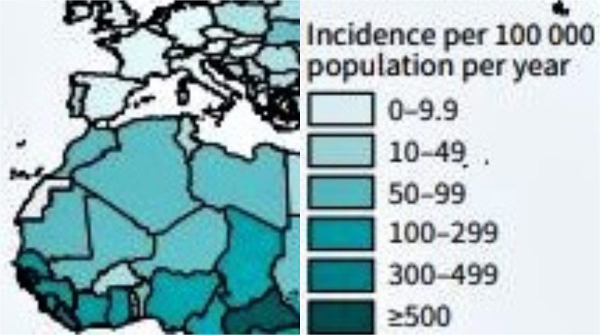 La tuberculosis, en los "Diálogos de Salud Respiratoria" - EFE Salud
