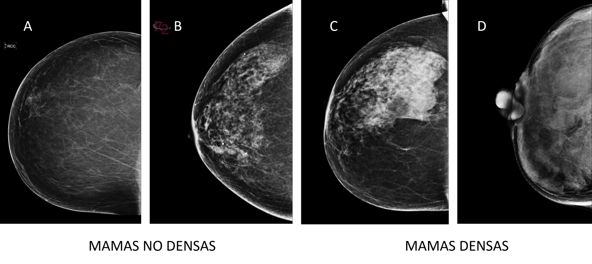 Mama Densa é Perigoso - RETOEDU