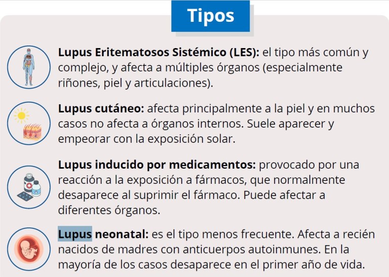 La medicina de precisión busca personalizar el abordaje del lupus