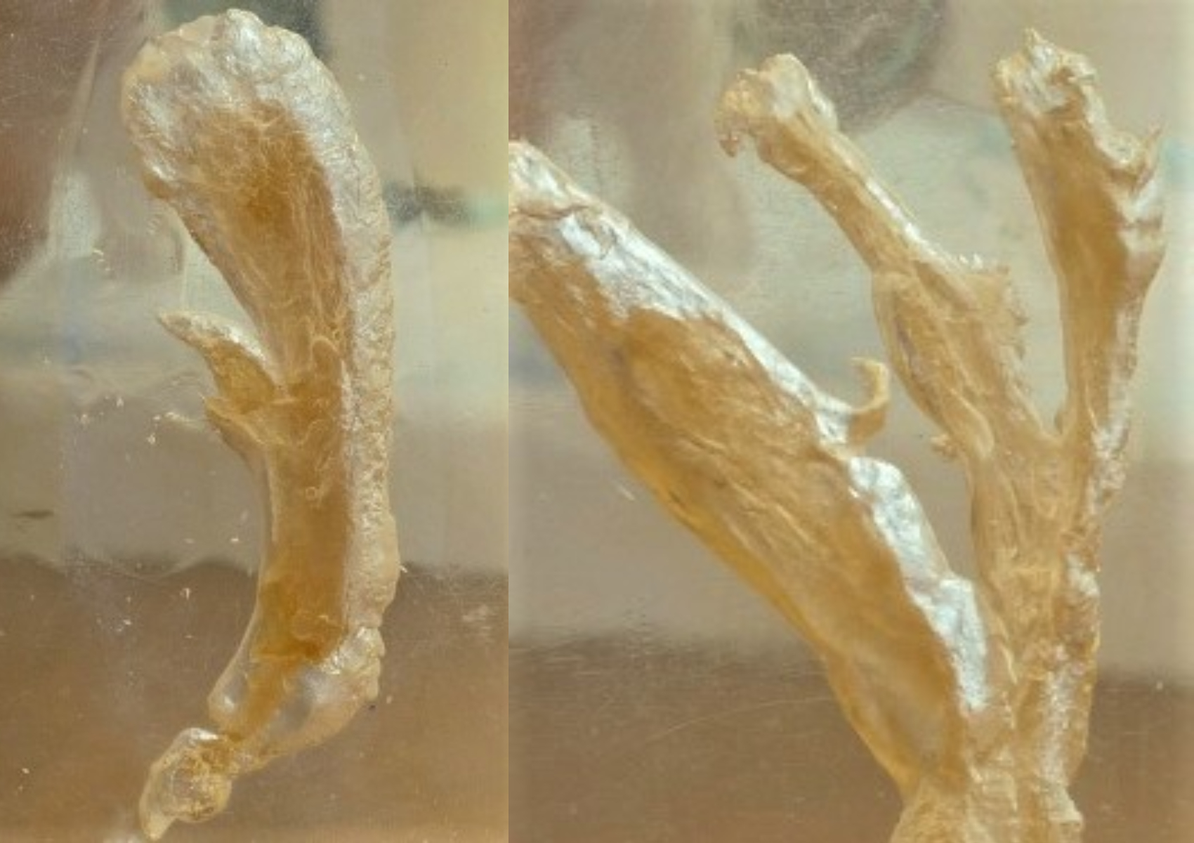 Lanugo: qué es y cuál es su función en el cuerpo - Noticias de Argentina y el Mundo