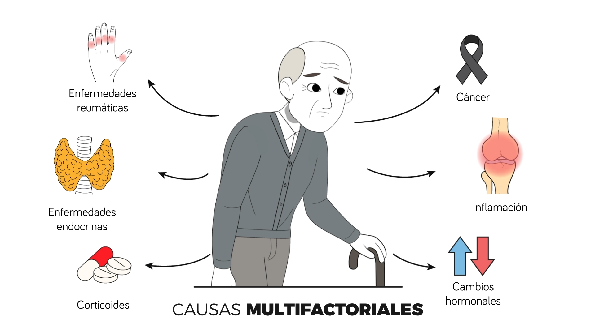 Mayores con pérdida de masa muscular: puede ser sarcopenia